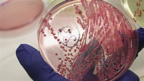 Isolation Of Microorganisms Youtube