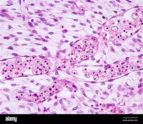 Epitelio Escamoso Simple Fotografías E Imágenes De Alta Resolución Alamy
