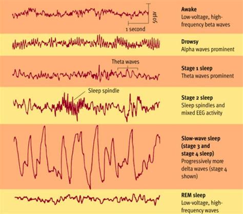 Sleep Stages And Brain Waves