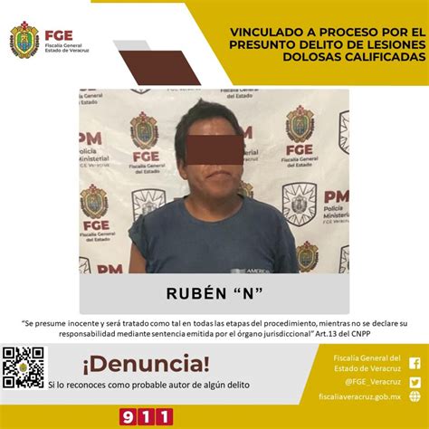 Es Vinculado A Proceso Por El Presunto Delito De Lesiones Dolosas