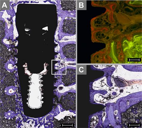 Osseointegration Of Dental Implants In Ectopic Engineered Bone In Three