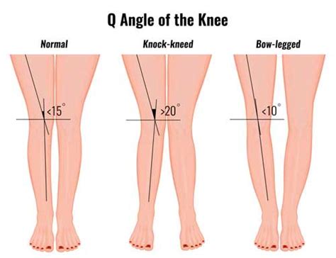 Q Angle Of The Knee Explained