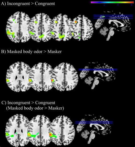 Brain Activation Maps Showing Significant Cluster Of Activations For