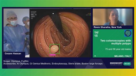 Colonoscopy And Polypectomy Endoscopy On Air