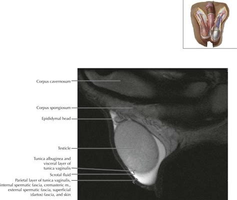 Scrotum And Testes Radiology Key