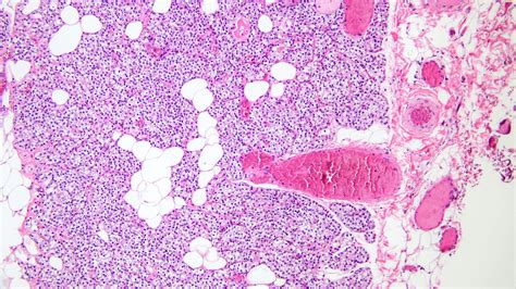 Pathology Outlines Anatomy And Histology Parathyroid