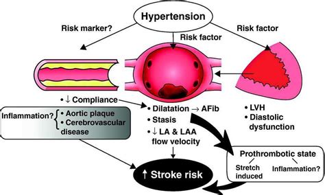 Xarelto Stroke Prevention In Nonvalvular Atrial