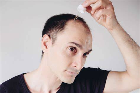 Dlq01 New Hair Loss Drug Ieson Forum
