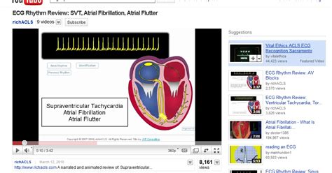 nursing and life ekg tutorial