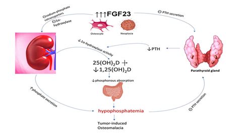 Correlation Between Serum Phosphate Levels And Vitamin D Pth And