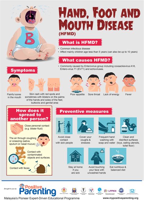 What Is Hand Foot And Mouth Disease Hfmd And How To Prevent It