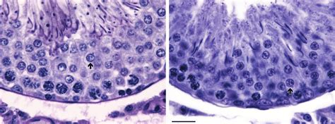 Micrographs Taken From 2 Paraffin Embedded Testicular Tissue Adult