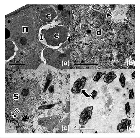 Transmission Electron Micrographs From The Testis After 4 Weeks Of