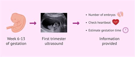 When Is The First Trimester Ultrasound Done