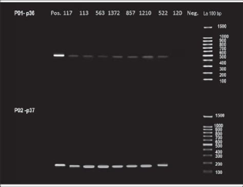 The Picture Of The Agarose Gel For 7 Biv Positive In Nested Pcr Top