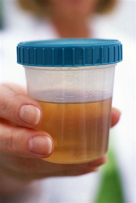 False Positive Or False Negative Std Test Results
