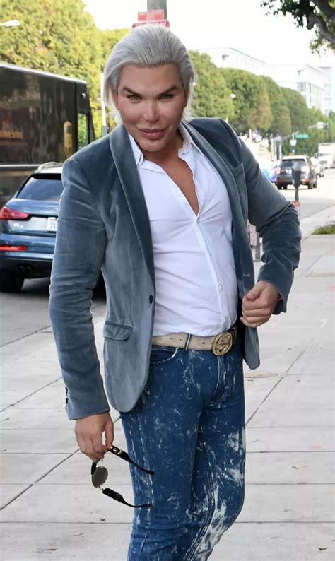 Human Ken Doll Rodrigo Alves Spends £19 000 On Surgery To Feminise His