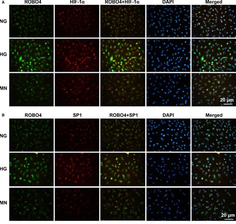 Abundance And Localization Of Hif‐1α Sp1 And Robo4 In Arpe‐19 Cells