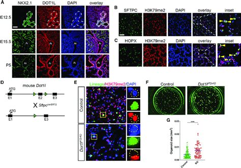 Dot1l Is Broadly Expressed In Developing And Adult Lung Epithelium And