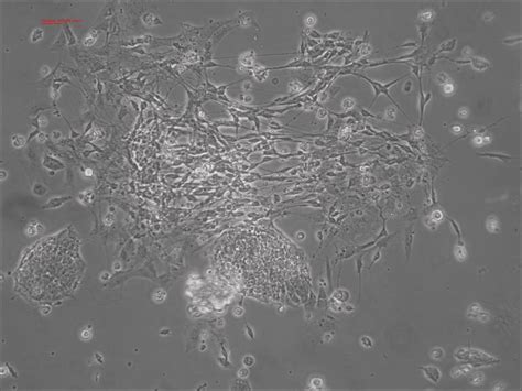 Neural Rosettes Alleleblog