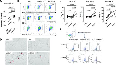 Kshv Preferentially Infects And Expands Cd14 Monocytes With An