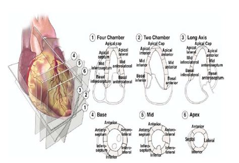 Show Segmental Analysis Of Lv Walls Based On Schematic Views A