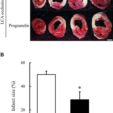 Administration Of Recombinant Progranulin Decreased Infarct Size After