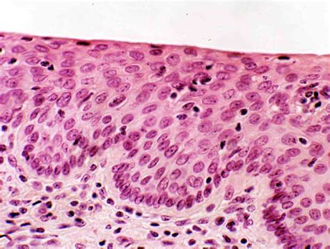 6 Types Of Epithelial Tissue