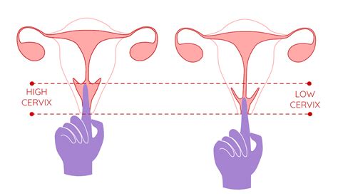 How To Check Your Cervix For Pregnancy Renew Physical Therapy