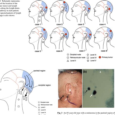 The Best 19 Occipital Lymph Nodes Greatmotherart