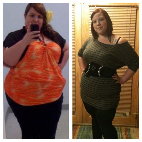 Gastric Sleeve Before And After 6 Months
