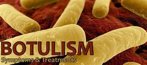 Botulism Causes Symptoms Infant Botulism Prevention And Treatment