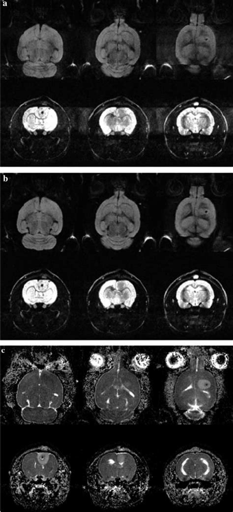 Diffusion Weighted Images Without A And With B Navigator Echo
