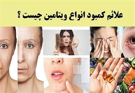 چگونه بفهمیم کدام ویتامین بدنمان کم است؟