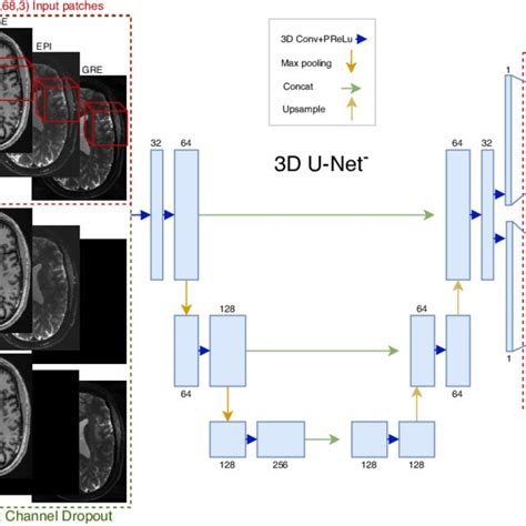 scheme of the 3d u net implemented in input the three mri contrasts