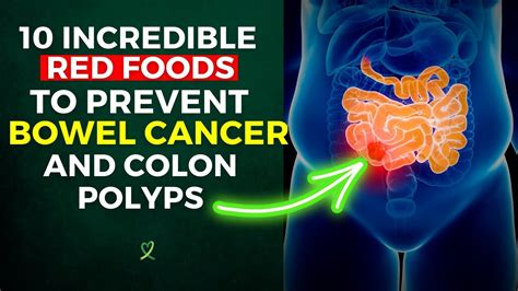 10 Incredible Red Foods To Prevent Bowel Cancer And Colon Polyps Youtube