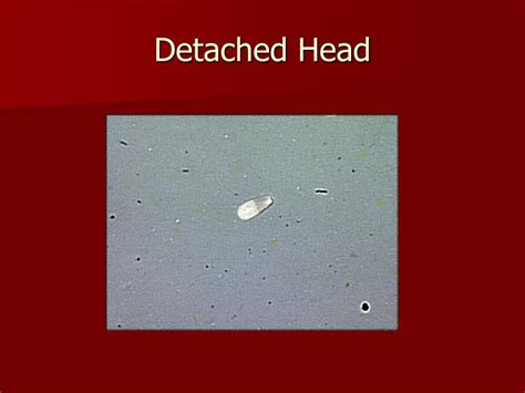 Ppt Semen Analysis Powerpoint Presentation Free Download Id 2983786