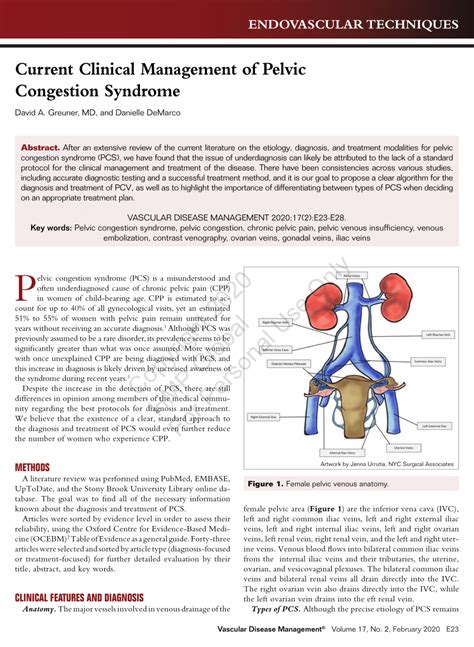 What Is Pelvic Congestion Syndrome Treatment