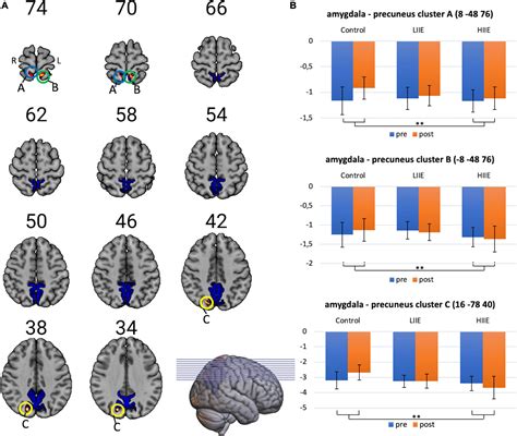 Frontiers Differential Modulation Of Resting State Functional