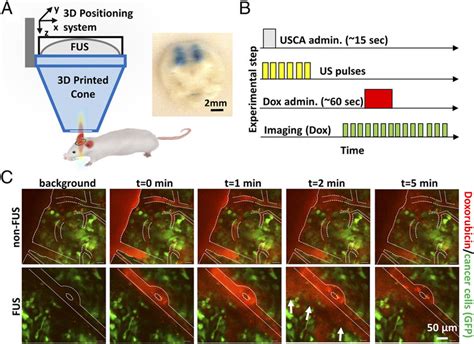 Fus Enhances Doxorubicin Extravasation In Bt474 Gluc Brain Tumors A