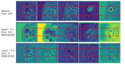 using pspnet and unet to analyze the internal parameter