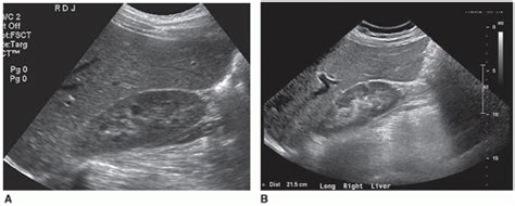 The Liver Radiology Key