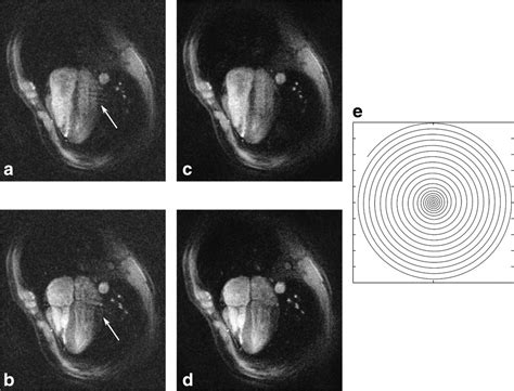 spirit iterative self‐consistent parallel imaging reconstruction from