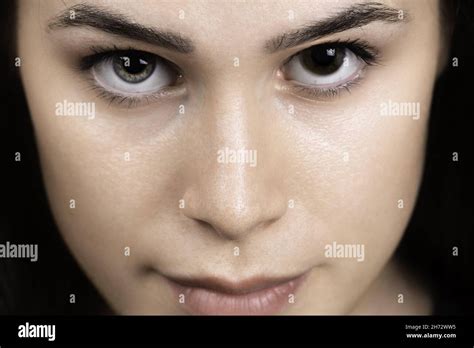 Face Close Up Of A Girl With Heterochromia Iridum In Her Eyes Stock