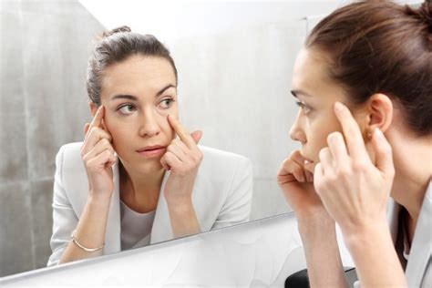 How To Treat Dark Circles And Bags Under My Eyes Henry F Garazo Md