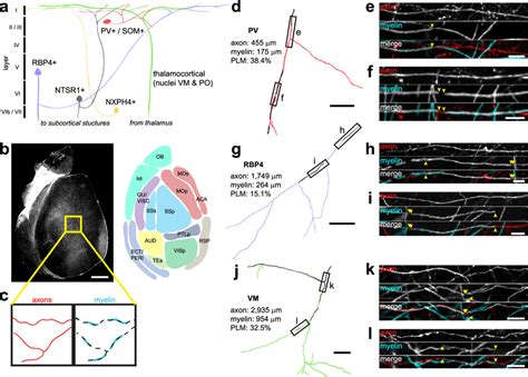 High Resolution Tracing Of Distinct Axon Populations Reveals
