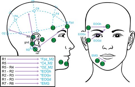 Frontiers Pre Gelled Electrode Grid For Self Applied Eeg Sleep