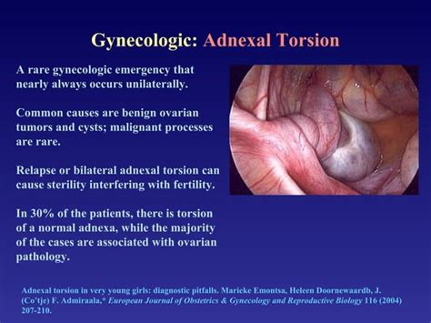 Diagnostic Laparoscopy For Pelvic Disorders