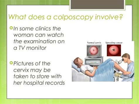 Colposcopy
