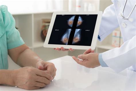 How To Detect Breast Cancer Early Revolution Pages